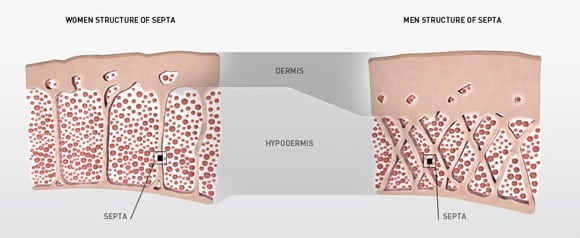 Cellulite: What is it and How to Combat it - Personal Training